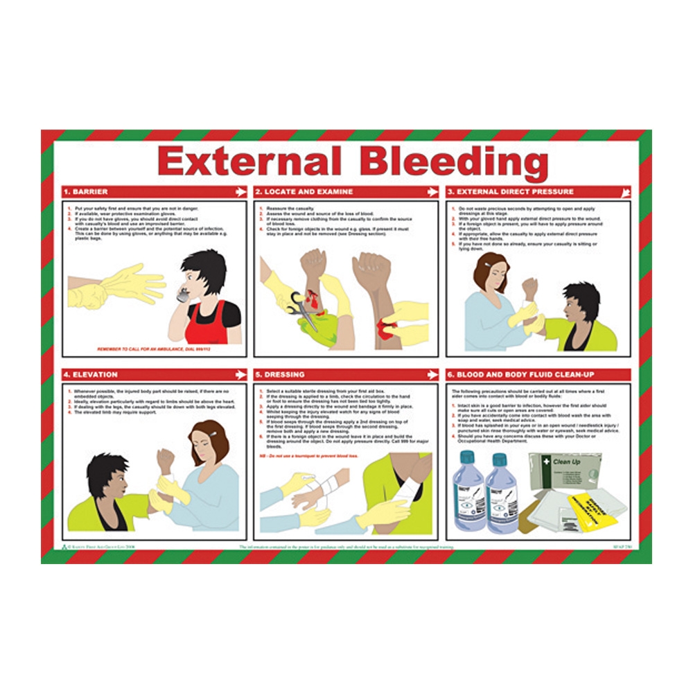 External bleeding 590mm x 420mm Laminated Poster | Tiger Supplies